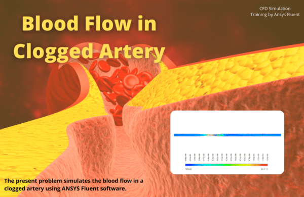 Blood Flow in Clogged Artery CFD Simulation by ANSYS Fluent Training ...