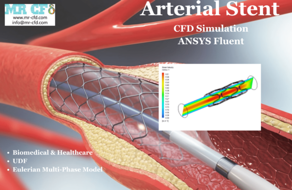 Arterial Stent CFD Simulation, ANSYS Fluent - MR CFD