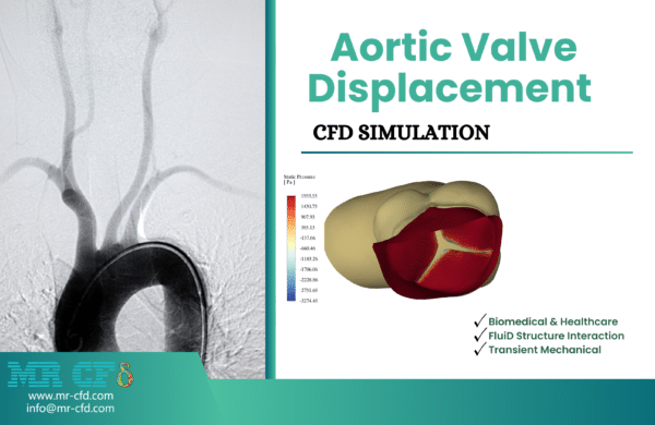 Aortic Valve Displacement CFD Simulation - MR CFD
