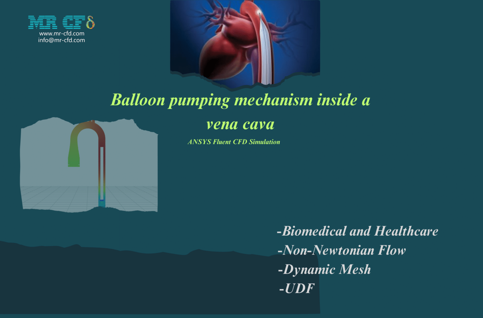 balloon pumping-mechanism-inside-a-vena-cava